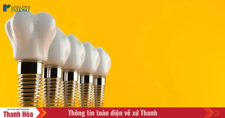 Trồng răng implant có nguy hiểm không? Parkway giải đáp